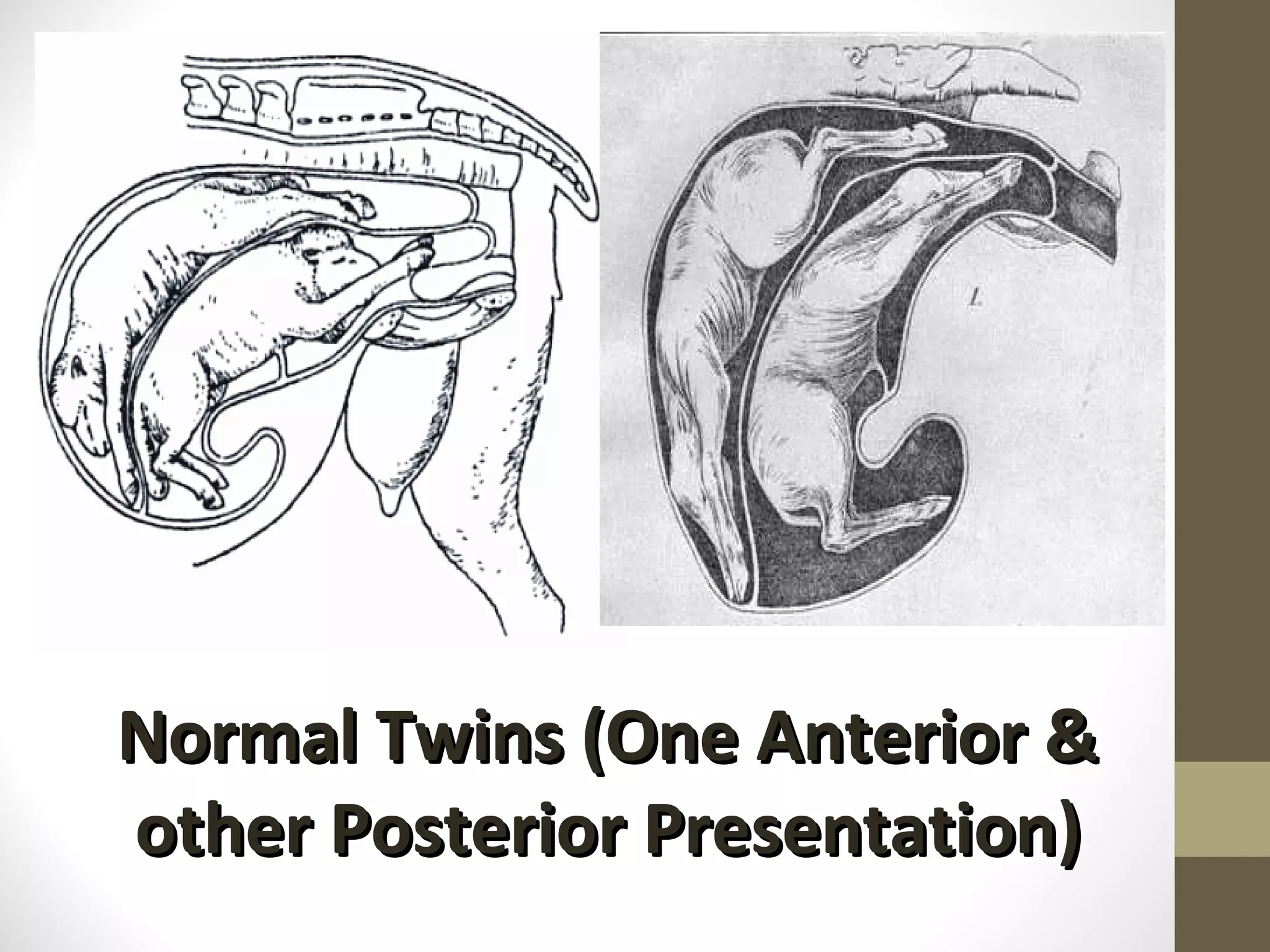 5th year practical revision fetal presentations | PPT