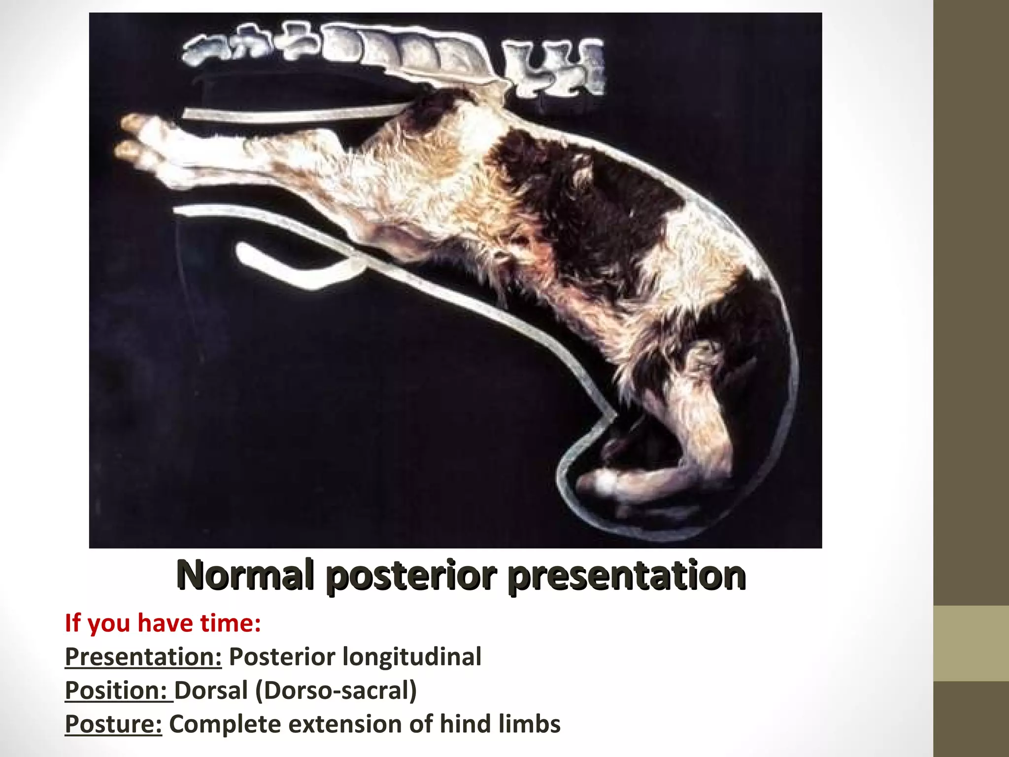 5th year practical revision fetal presentations | PPT