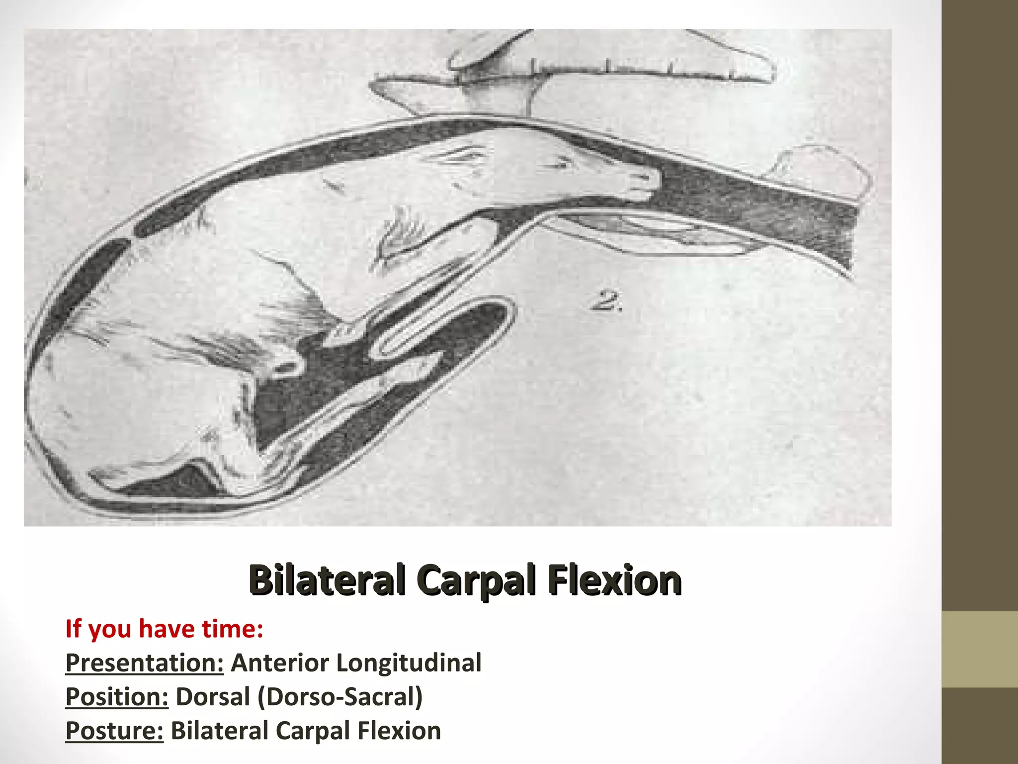5th year practical revision fetal presentations | PPT