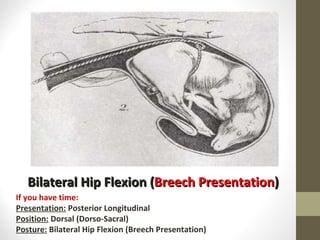 Breech Presentation In Cattle