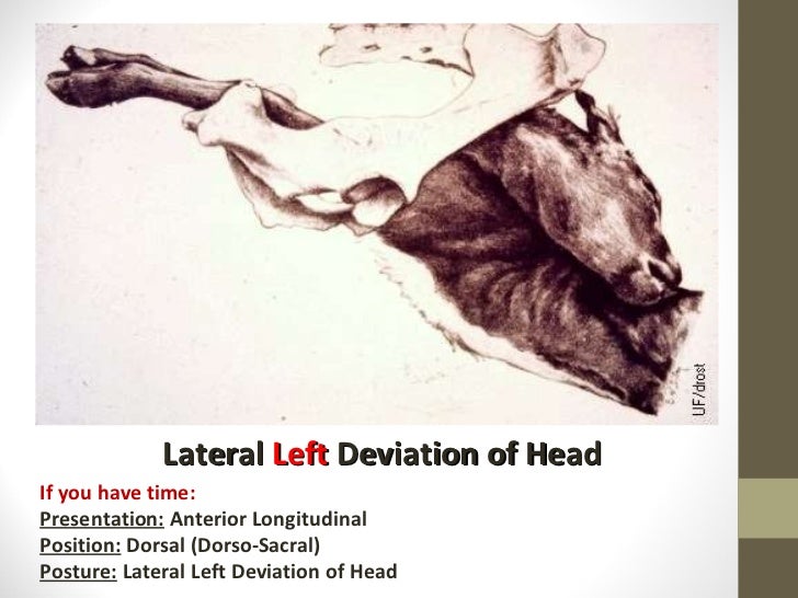 5th year practical revision fetal presentations