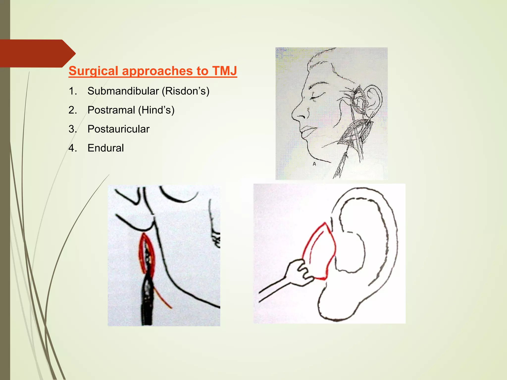 5 tmj ankylosis | PDF