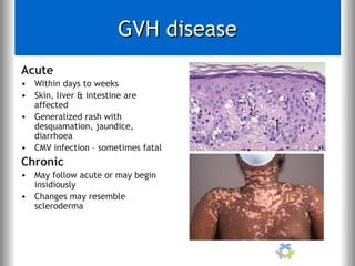 5 Transplant pathology&Amyloidosis.pptmdpath | PPT