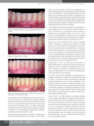 Tratamiento de las recesiones gingivales | PDF