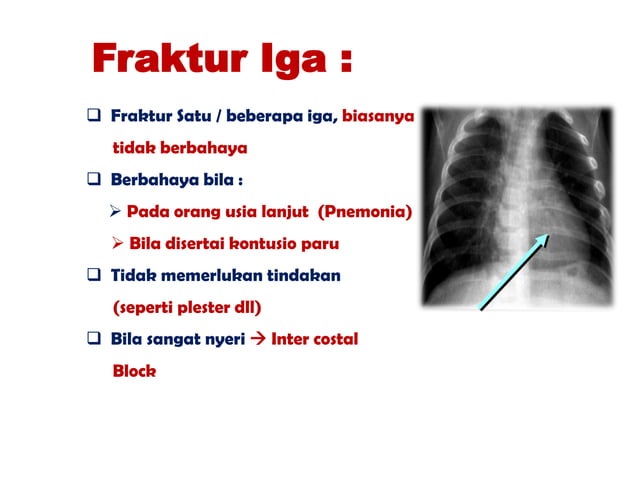 5 Trauma Thorak | PDF