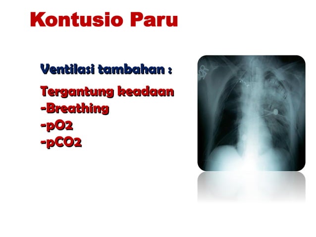 5 Trauma Thorak | PDF