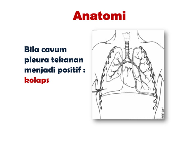 5 Trauma Thorak | PDF