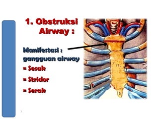 5 Trauma Thorak | PDF