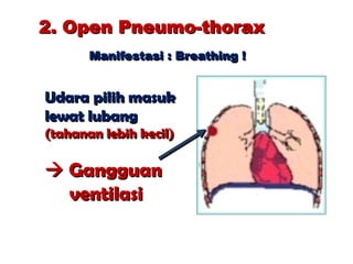 5 Trauma Thorak | PDF
