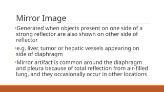 5 Ultrasound Artifacts in imaging2.pptx