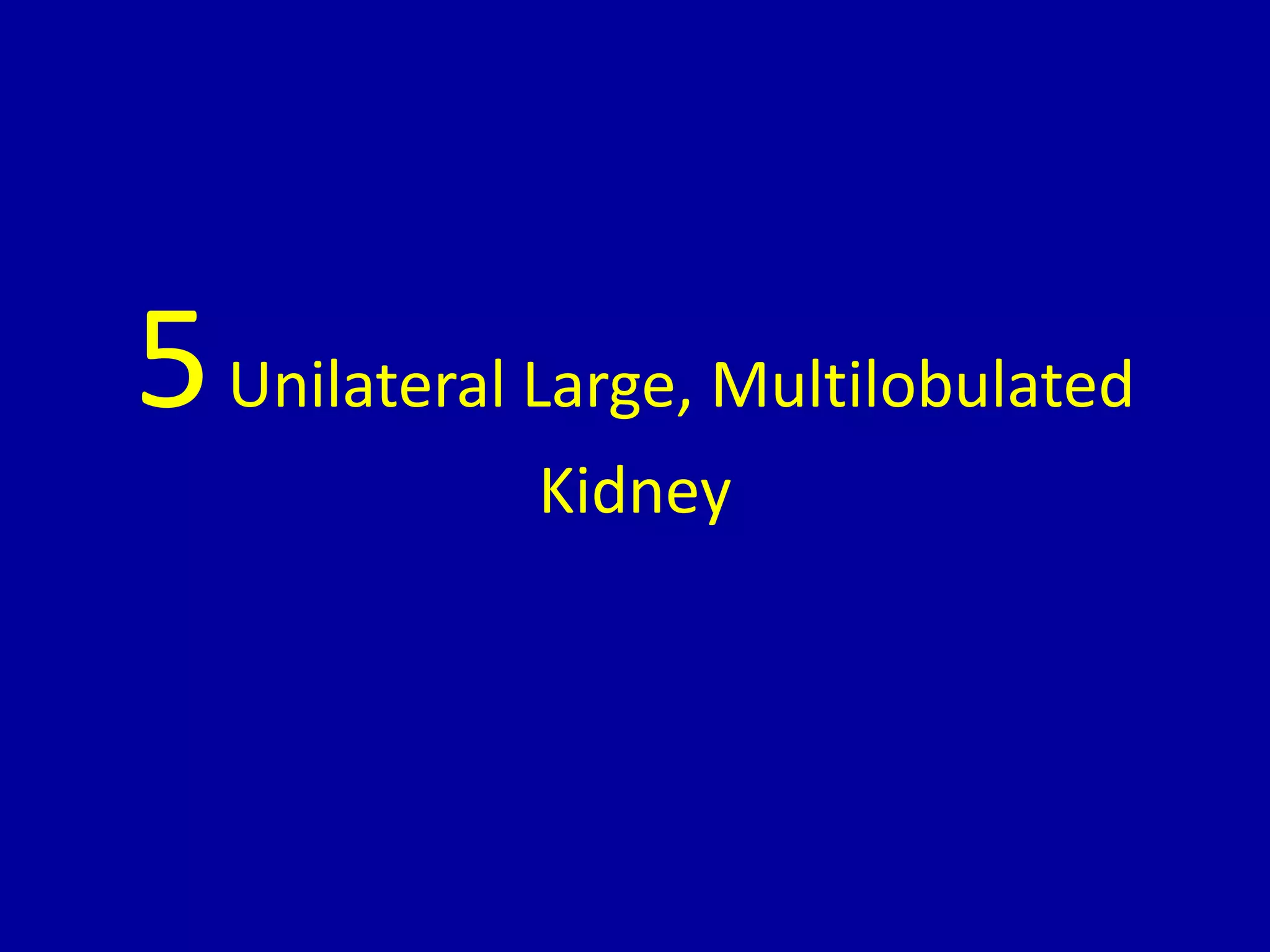 5 unilateral large, multilobulated kidney | PPTX