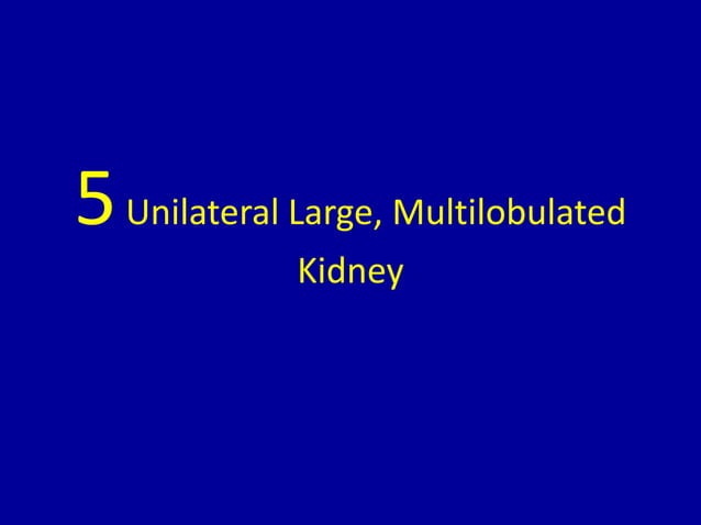 5 unilateral large, multilobulated kidney | PPT
