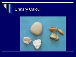Urinary Tract Infection | PPT