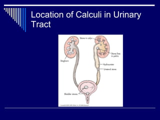 Urinary Tract Infection | PPT
