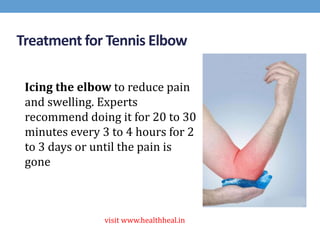5 ways to prevent tennis elbow | PPT