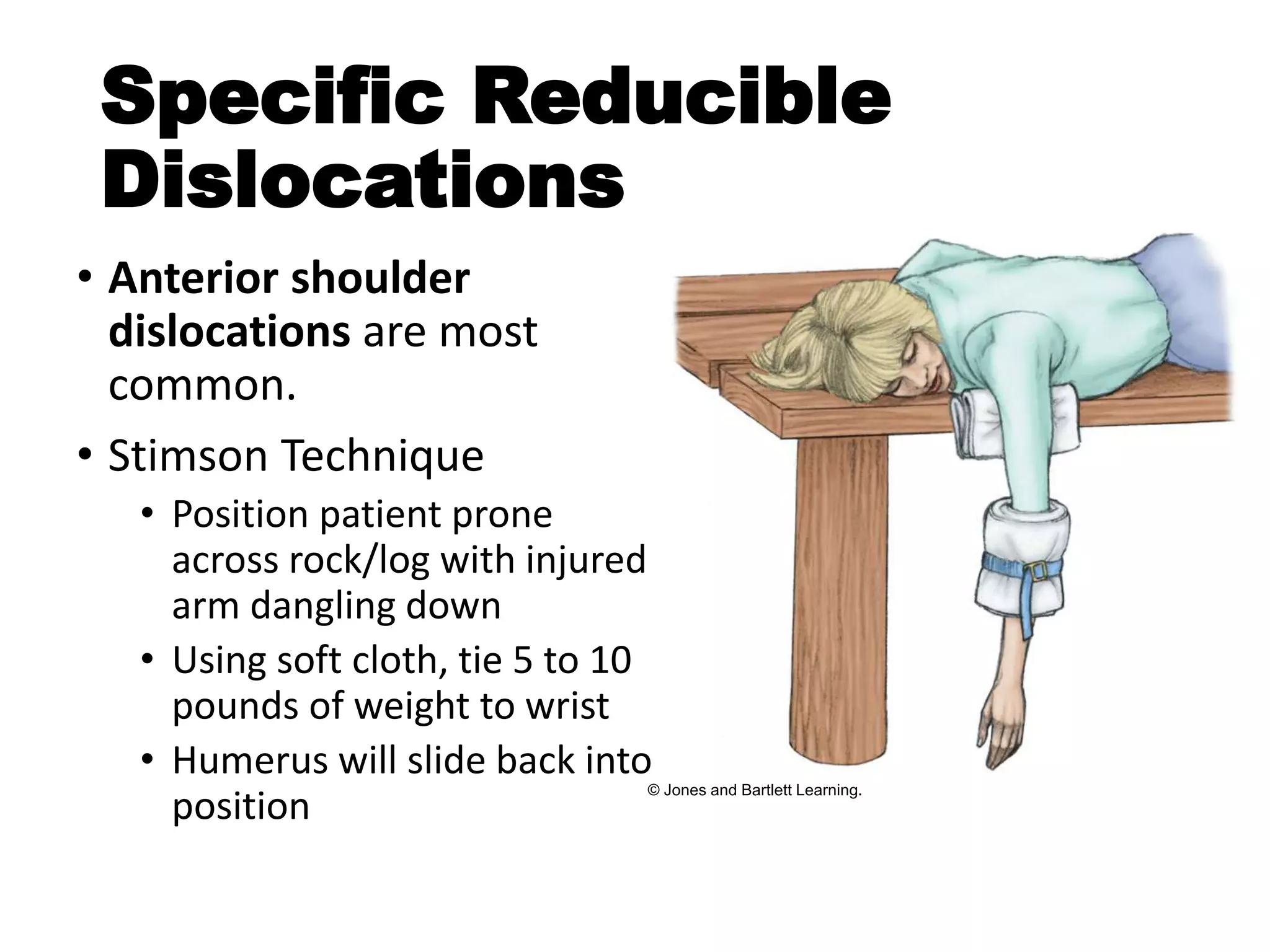 5 wfa bone and joint injuries | PPTX