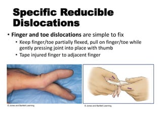 5 wfa bone and joint injuries | PPTX