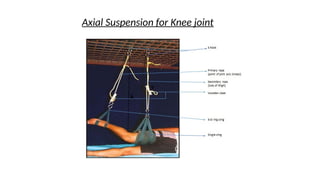 Suspension therapy knee joint, exercise therapy | PPTX