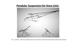 Suspension therapy knee joint, exercise therapy | PPTX