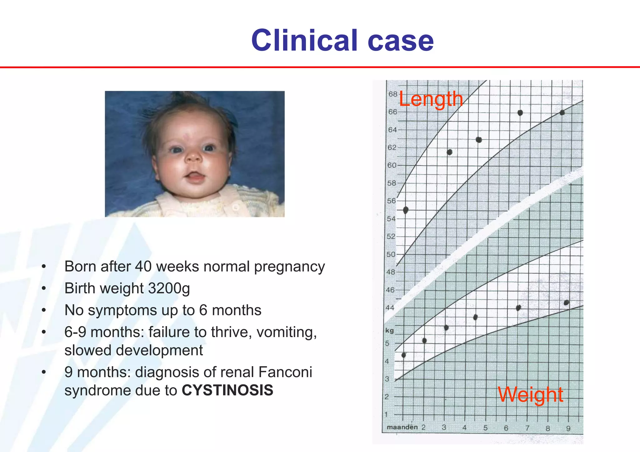 6-1. Cystinosis. Elena Levtchenko (eng) | PPTX