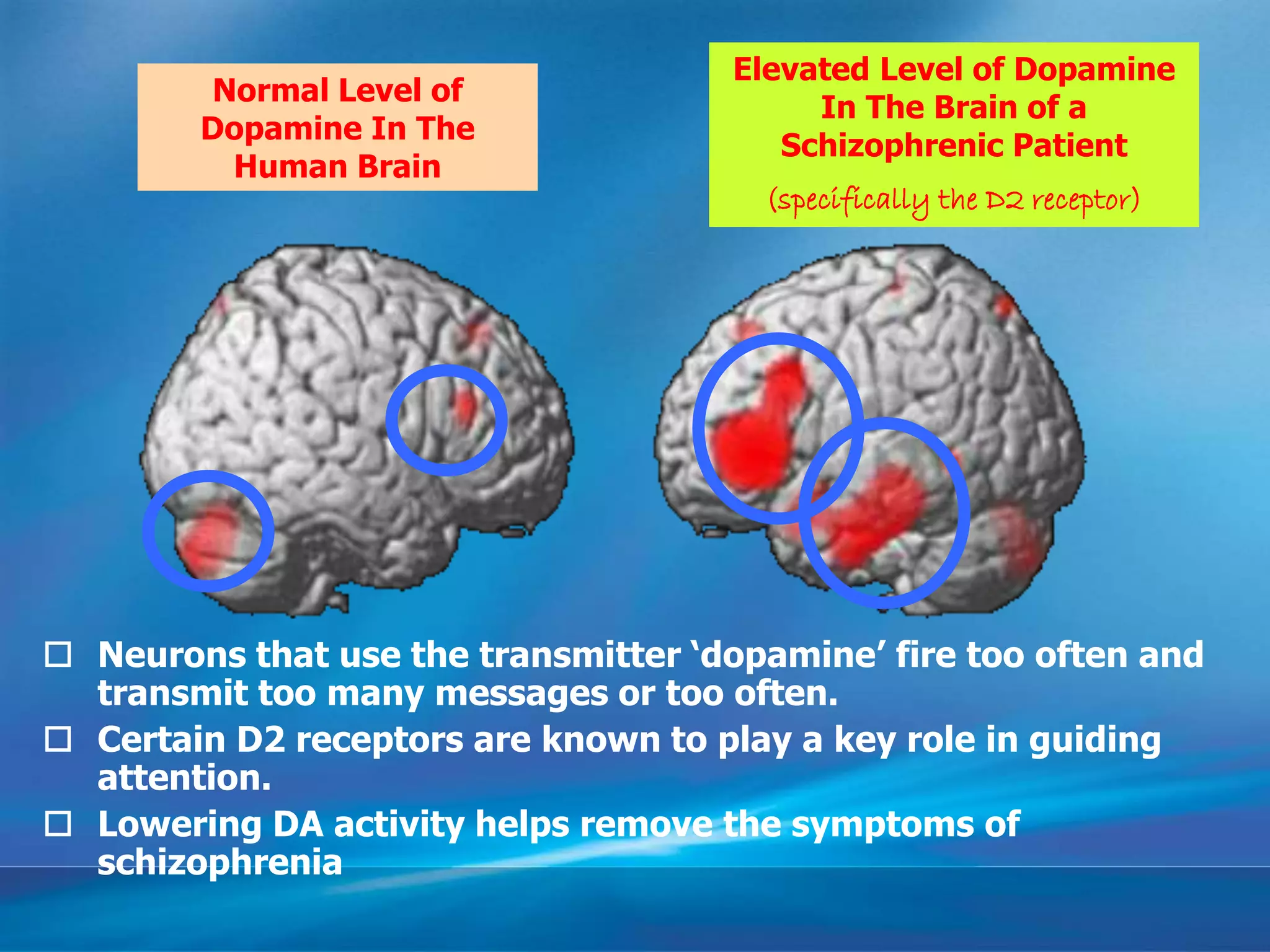 Biological aspects of schizophrenia | PPTX