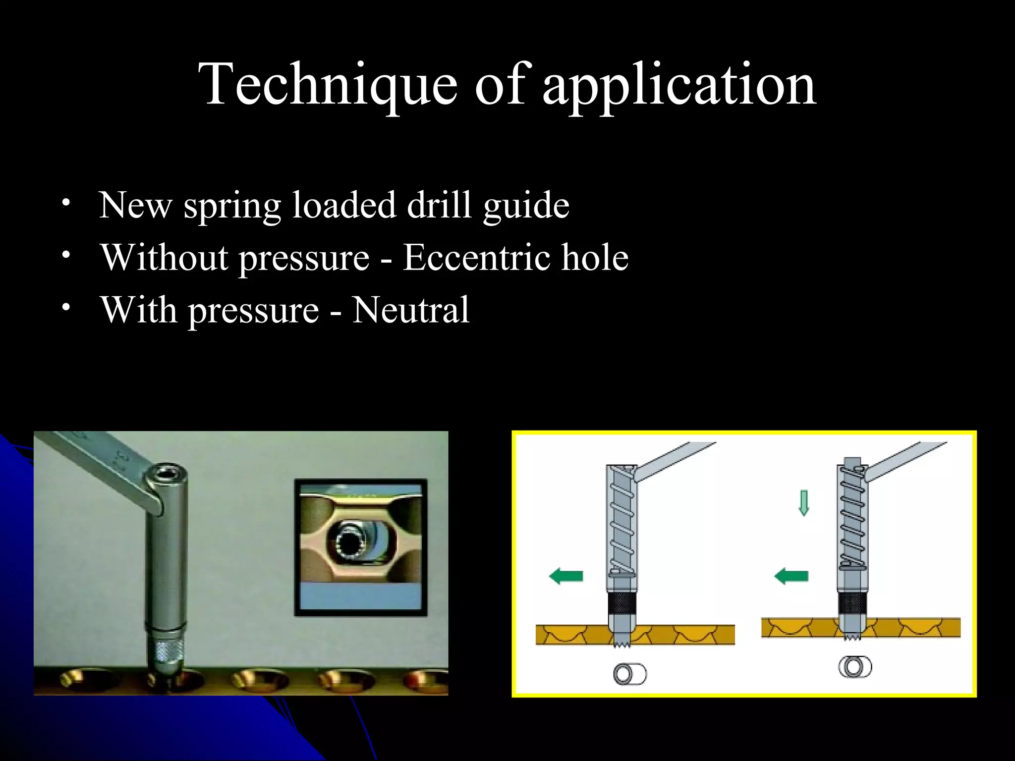 Plates-form and function | PPT