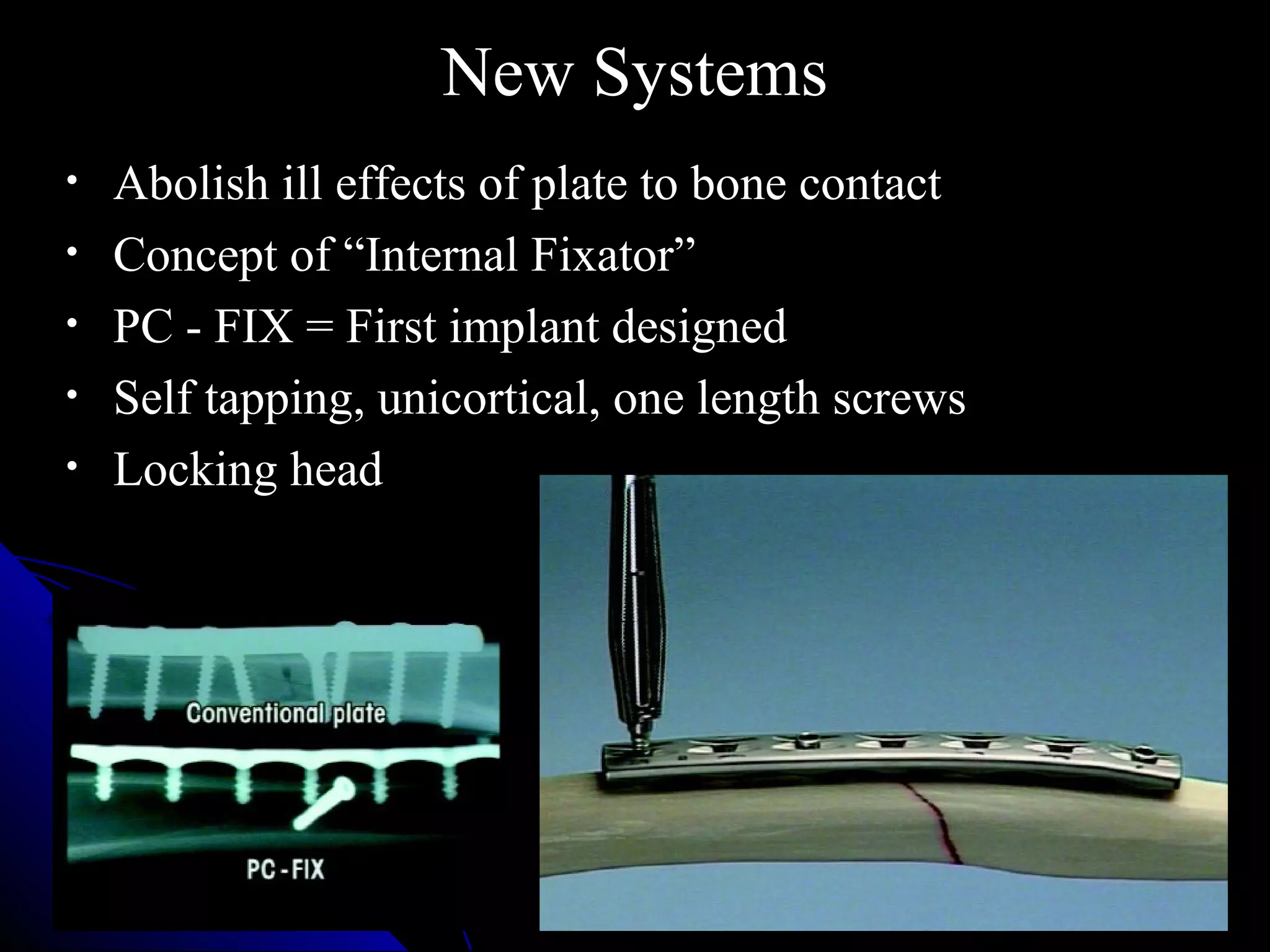 Plates-form and function | PPT