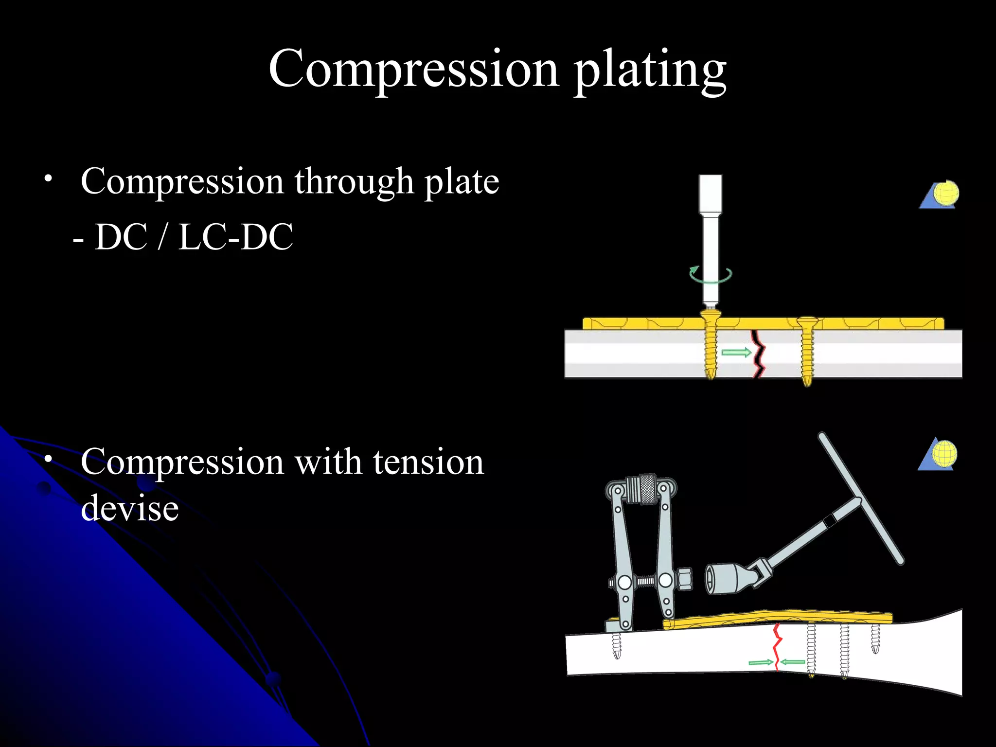Plates-form and function | PPT
