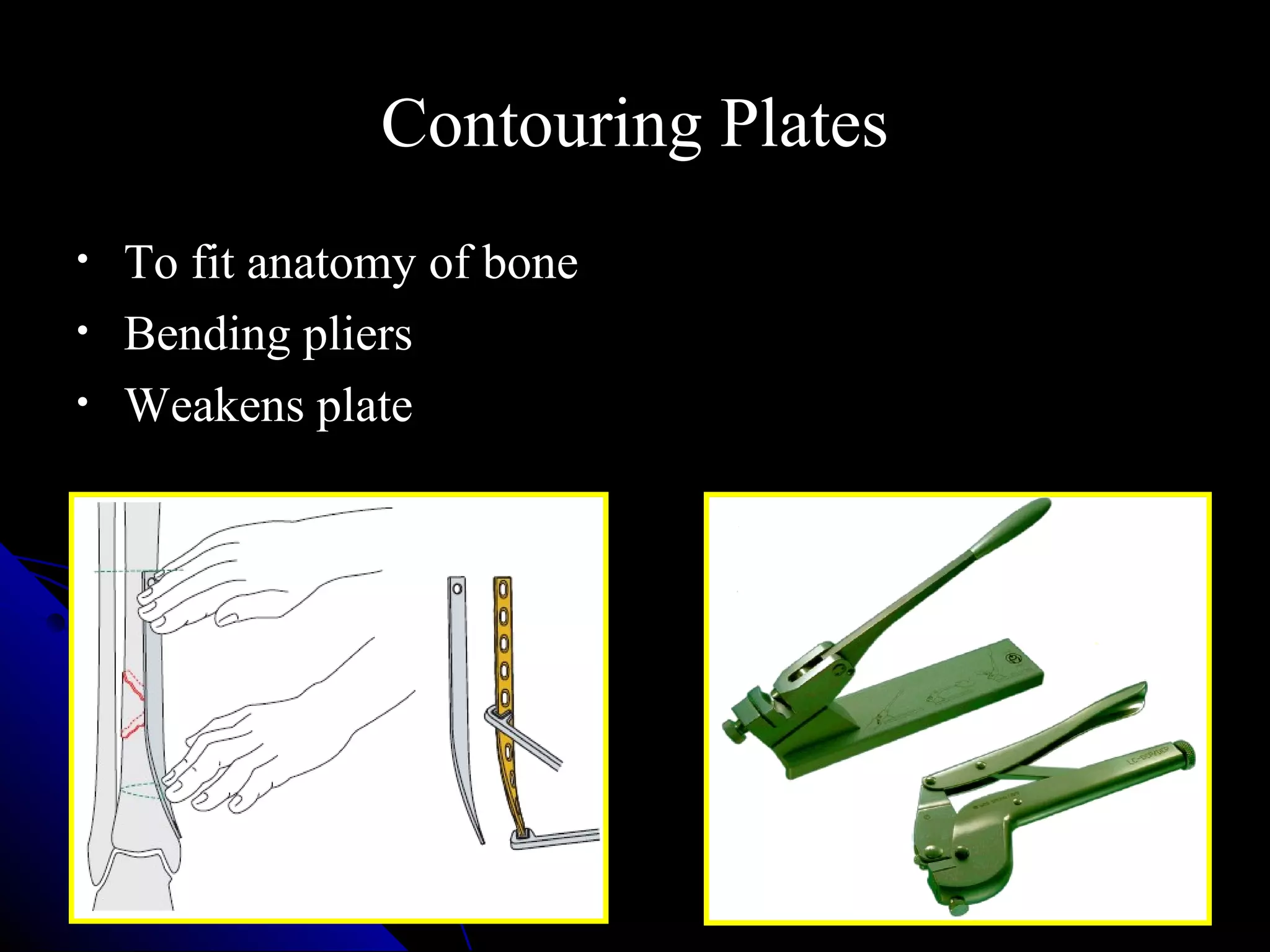 Plates-form and function | PPT