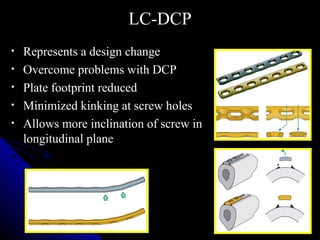 Plates-form and function | PPT