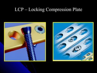 Plates-form and function | PPT