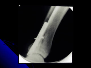 Plates-form and function | PPT