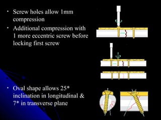 Plates-form and function | PPT