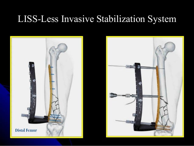 Plates-form and function