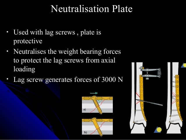 Plates-form and function