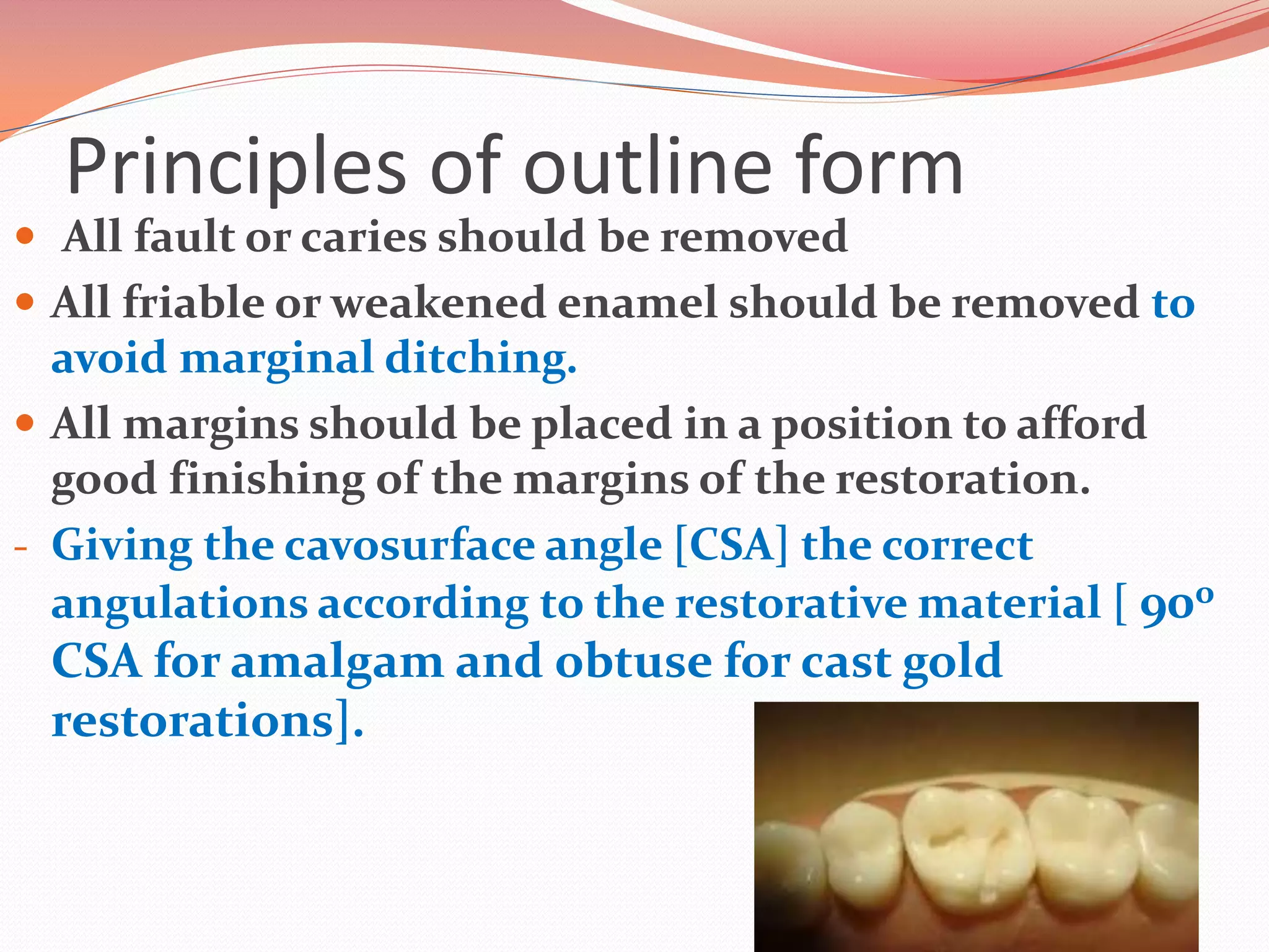 principles of cavity preparation | PDF