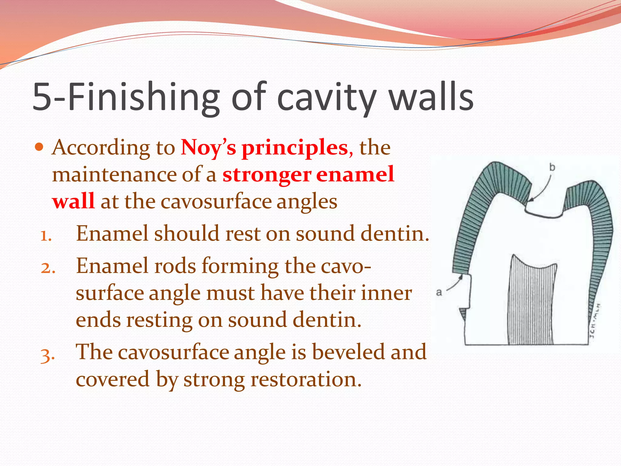 principles of cavity preparation | PDF