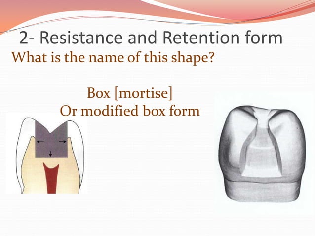 principles of cavity preparation | PDF | Dental Health | Diseases and ...