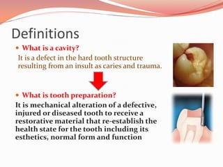 principles of cavity preparation | PDF