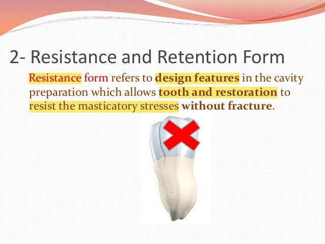 principles of cavity preparation