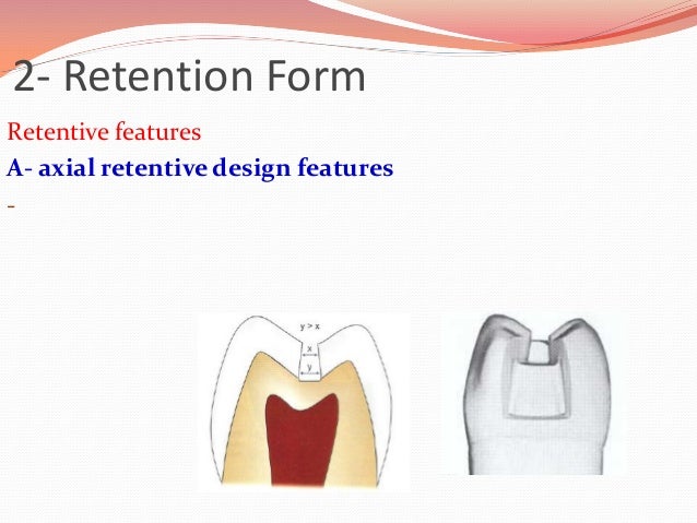 Retentive Definition