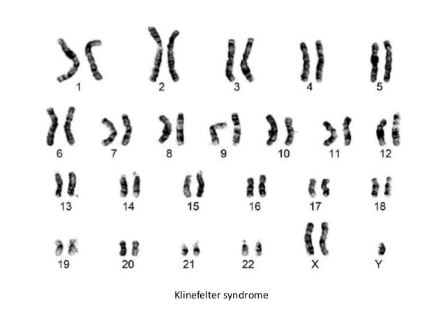 Xyy Chromosome