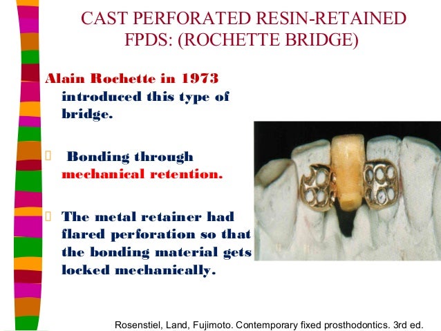 6.my unconventional fpd