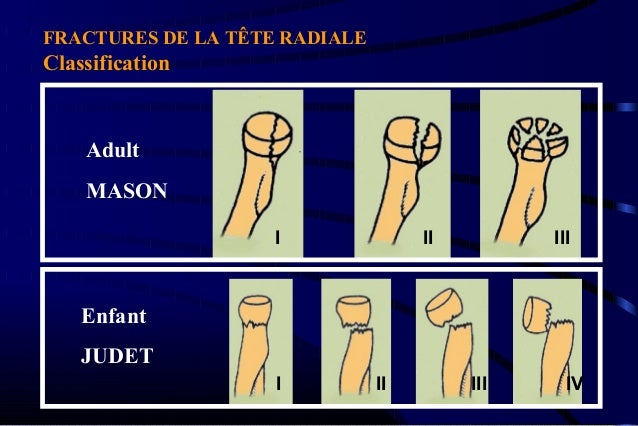 6.fracturi mb sup fr