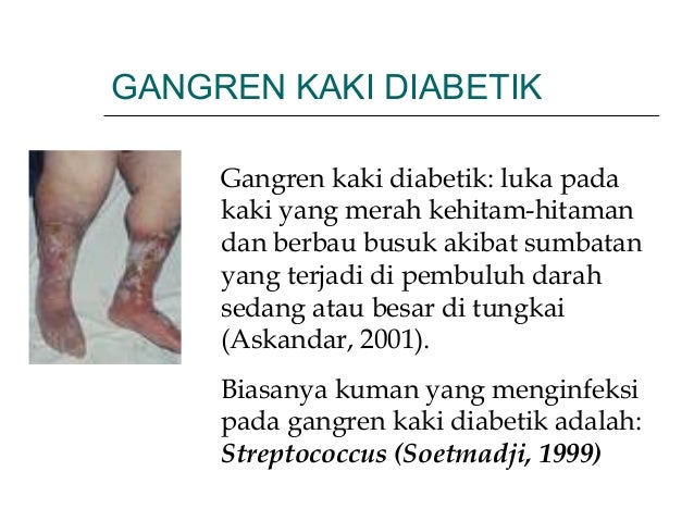 6 Perawatan Luka Gangren Akper Pemkab Muna