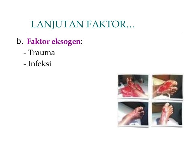 6 Perawatan Luka Gangren Akper Pemkab Muna