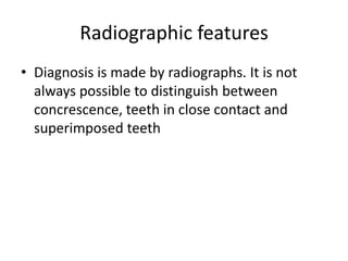 6.concrescence | PPTX
