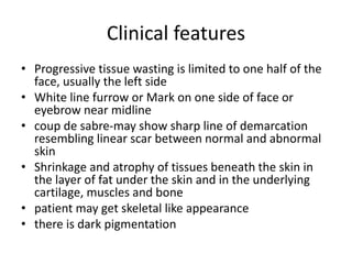 6.facial hemiatrophy | PPTX