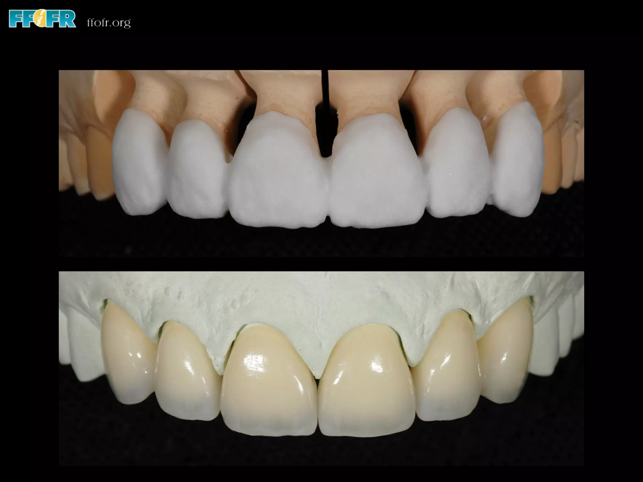 6. secondary imp materials | PDF