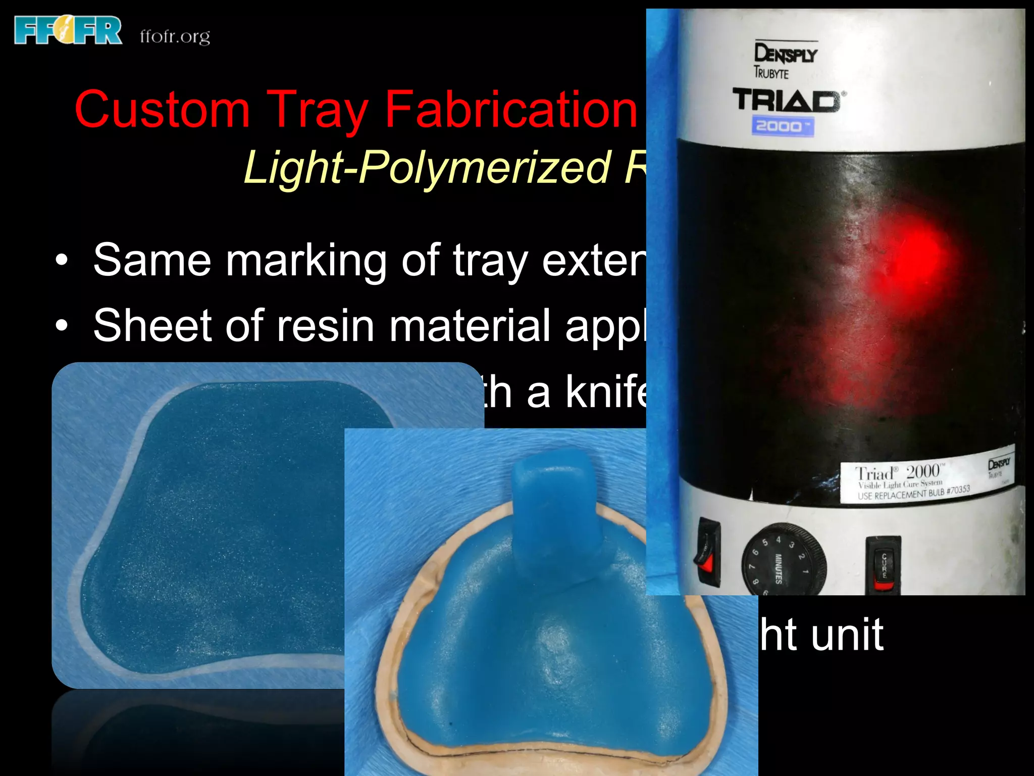 6. secondary imp materials | PDF | Dental Health | Diseases and Conditions